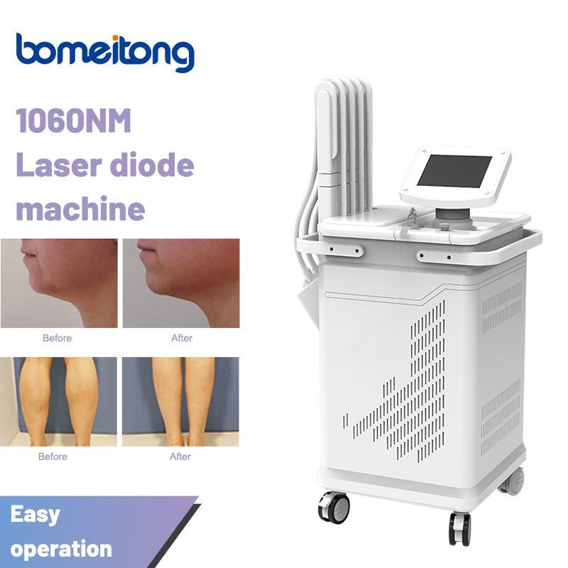 Sculpsure Body Contouring Fat Removal Machine Price 1060nm from China ...